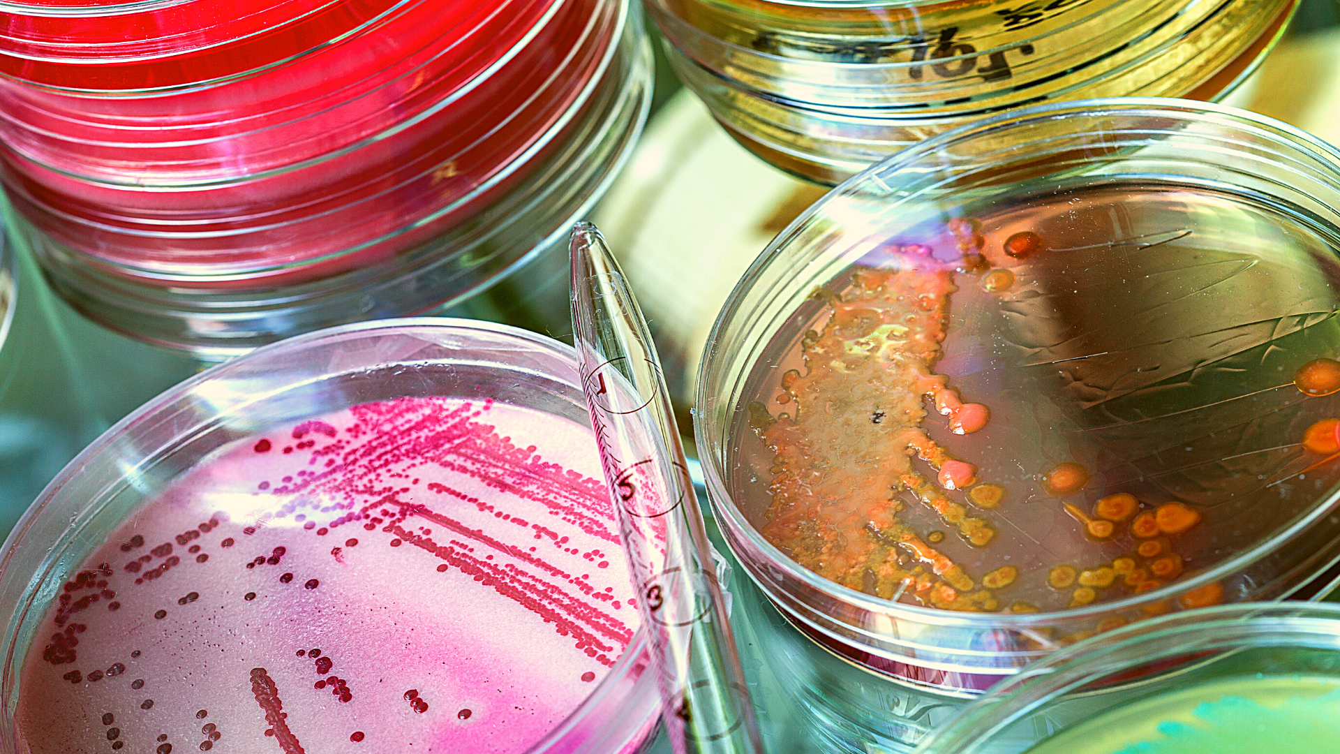 How to Test for Coliform Bacteria in Your Well Water | Your H2Home